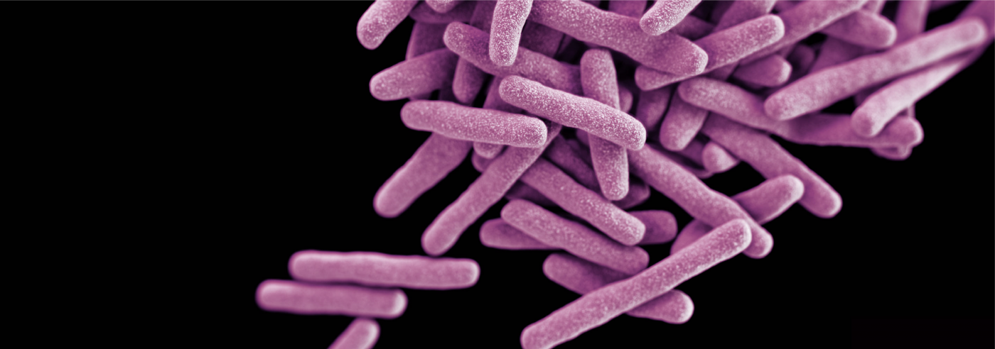 Home | University of Washington - Department of Global Health